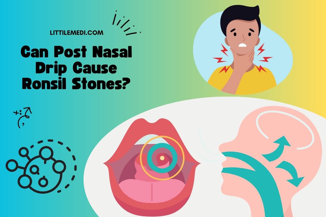 Can Post Nasal Drip Cause Tonsil Stones Best Medical Advice